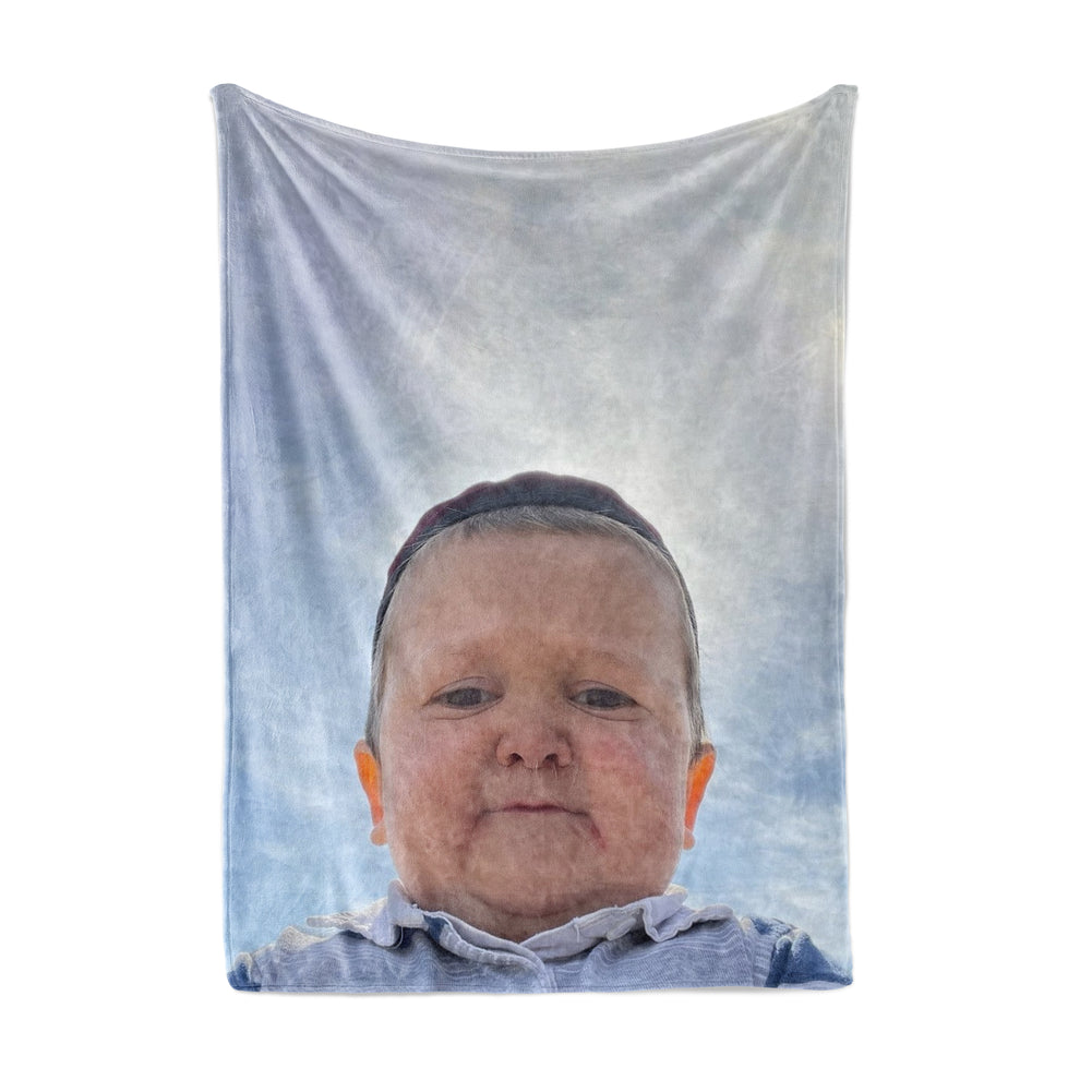 Hasbulla face – So Lucky